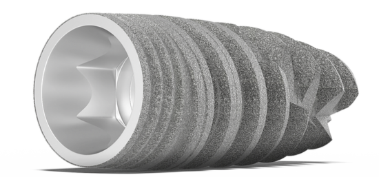 New TCX Implant – TOV Implant : blog officiel