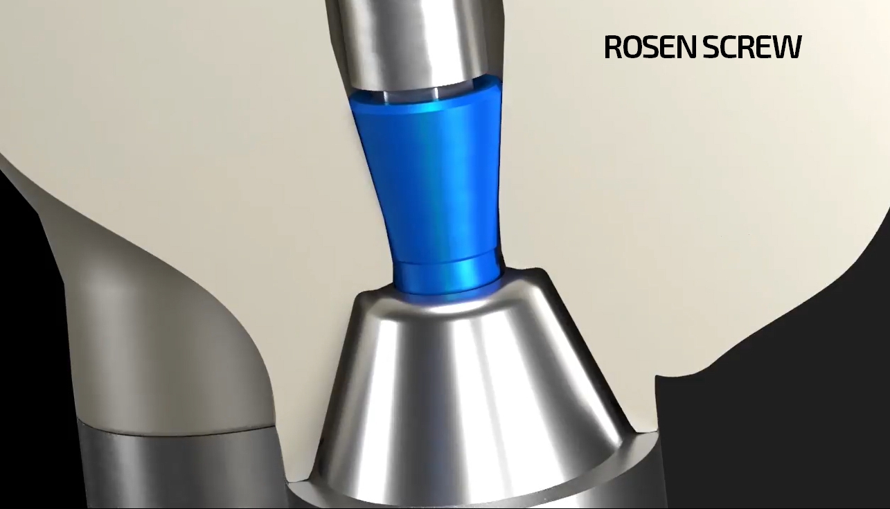 Rosen Screw – TOV Implant : blog officiel